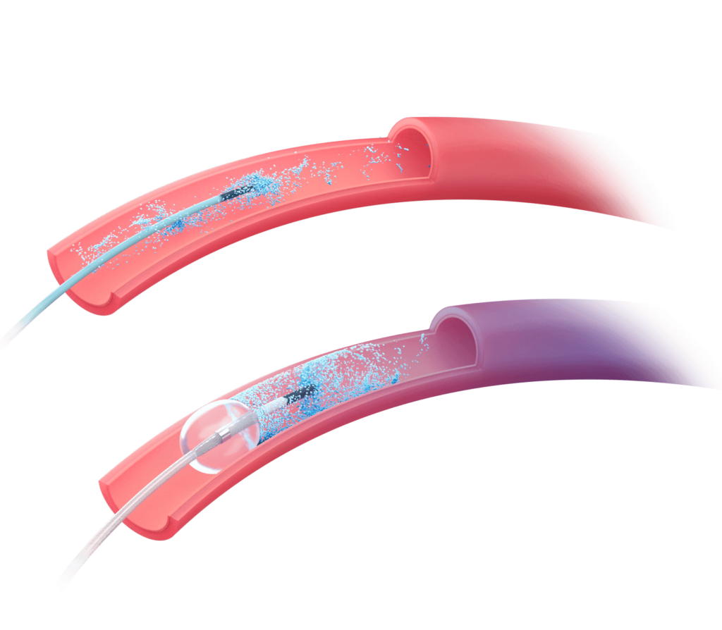 Science - Overcoming Intratumoral Pressure